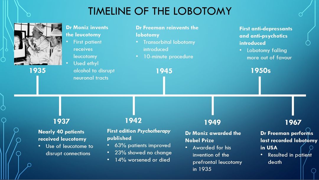 The history of lobotomy